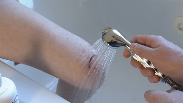 How to Heal a Scab: How To Talk Your Bumps Back to Beautiful Skin ...