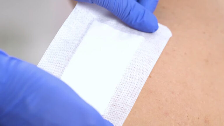 The Best and Worst Ideas for Open Wounds: The Do's and Don'ts ...