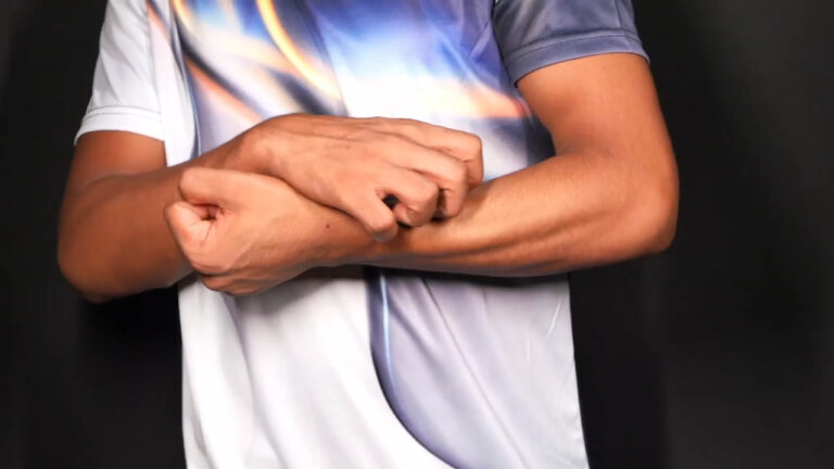 Understanding Wound Healing and the Itching Dilemma: The Unseen Journey