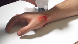 Understanding Wound Healing and the Itching Dilemma: The Unseen Journey